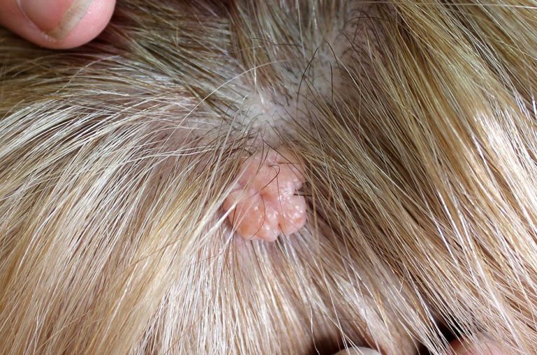 Services and Prices - Brighton Skin Surgery